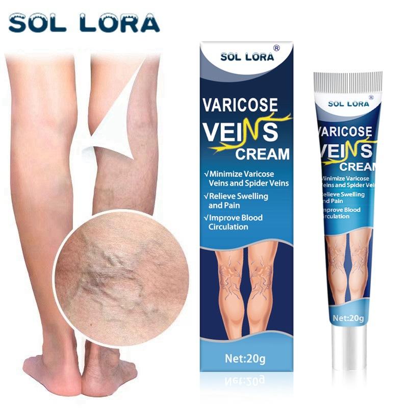 SOL LORA Varicose Veins Cream 20g - Gentle Moisturizer for Varicose Veins Relief & Improved ...